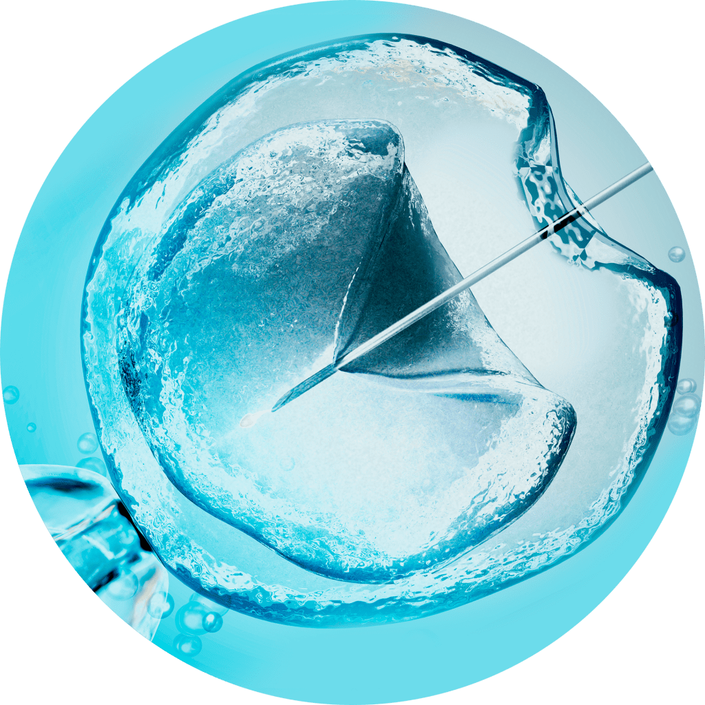 Fertilização In Vitro Com Icsi Art Fértil